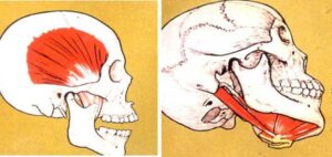 悪い噛み合わせが原因で起こる36の身体の異常・原因と解決法を徹底解説 - K.i 歯科｜経堂（世田谷区）の歯医者でかみ合わせ治療なら、不定愁訴に対する治療も対応可能な「K.i 歯科」まで